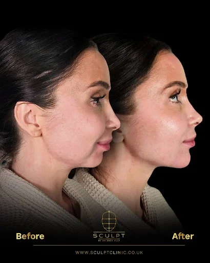 Aesthetic Treatment Packages in London | Sculpt Clinic